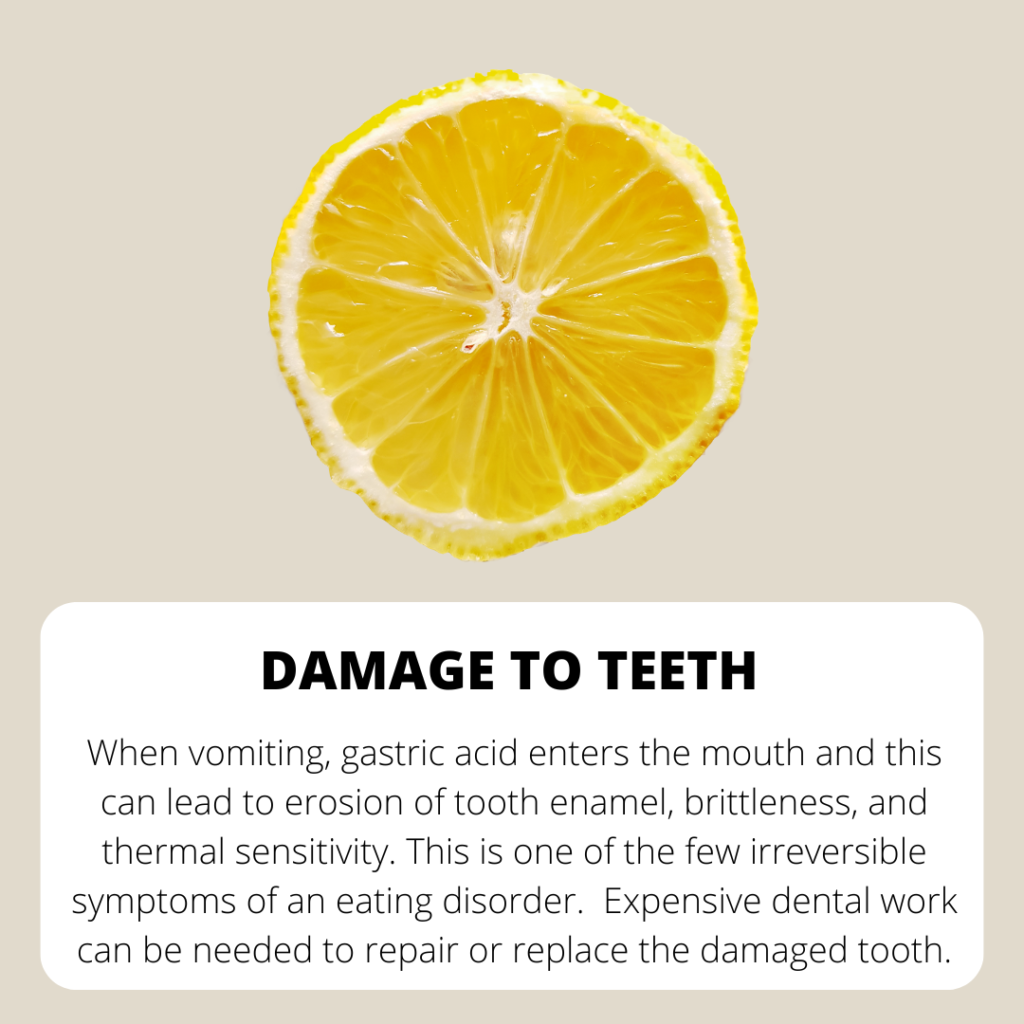 Purging: self-induced vomiting - Morgan Psychology